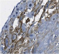 Anti-LOX-1, clone 9E12.1 | MABS186